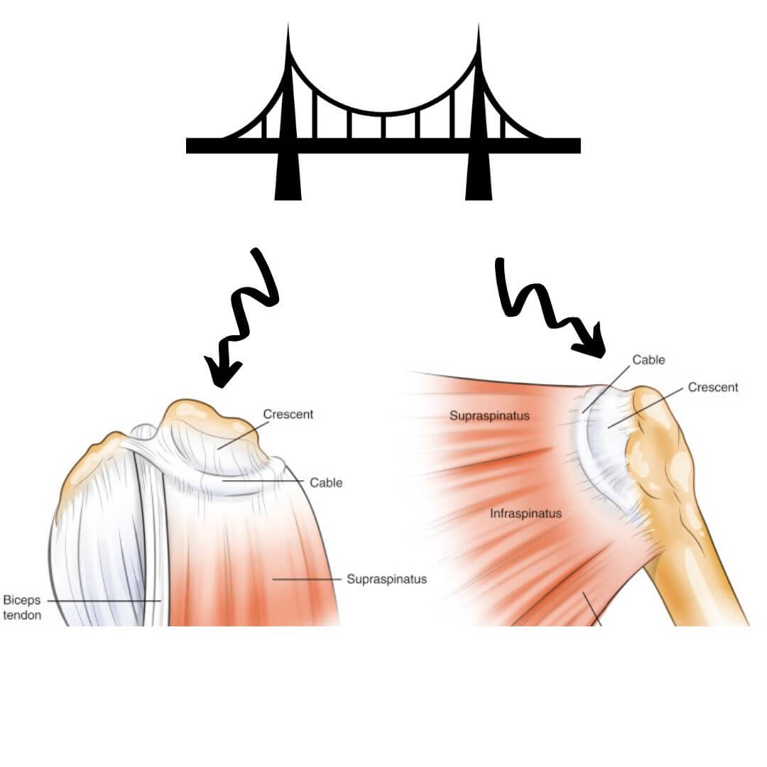 Rotator Cuff Injury - What is it? Diagnosis & treatment for Rotator ...