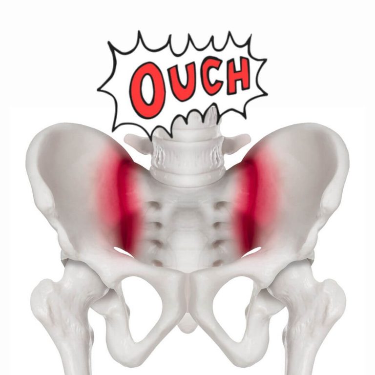 My Sacroiliac joint keeps popping out! Is this possible or not?